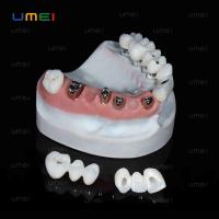 China Durable Dental Implant Crown And Bridge Minimally Invasive Zero Harm To Natural Dentition for sale