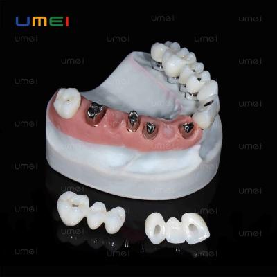 China Durable Dental Implant Crown And Bridge Minimally Invasive Zero Harm To Natural Dentition for sale