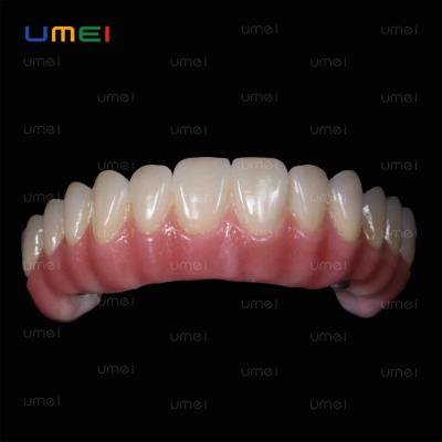 China Biocompatible Zirconia Dental Bridge , Crown And Bridge Dental Lab for sale