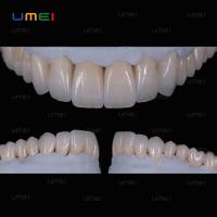 China High End Zirconia Crown Bridge Minimally Invasive High Hardness Dental PMMA Blocks for sale