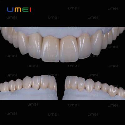 China High End Zirconia Crown Bridge Minimally Invasive High Hardness Dental PMMA Blocks for sale