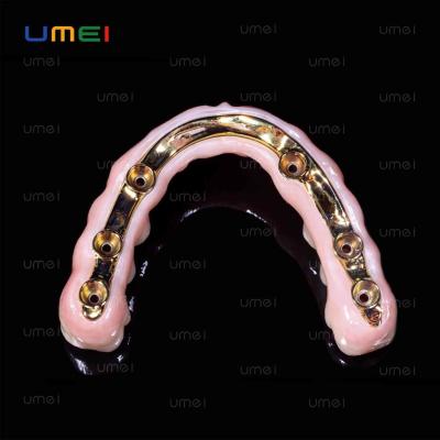 China Dental Full Arch Zirconia Bridge With Titanium Bar , Zirconia Aesthetic Attachment for sale