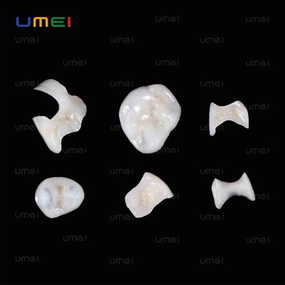 China High Strength Dental Inlay Onlay Restoration Natural Aesthetics E.Max Inlay For Dentistry for sale