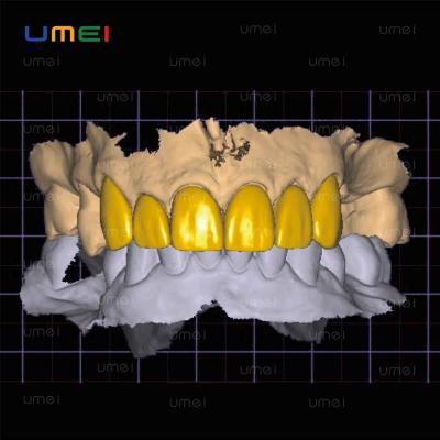 China Full Mouth Teeth CAD Design Dental Precise Modeling For Cosmetic Dentistry for sale