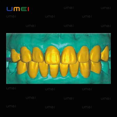 China High Precision Dental CAD Design Strong Personalization Production Oriented for sale