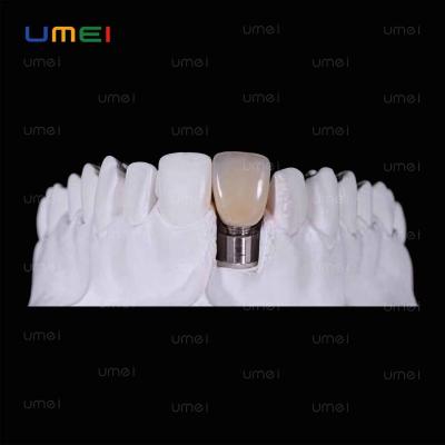 China Personalized Custom Abutment Implant Crown For Cosmetic Dentistry for sale