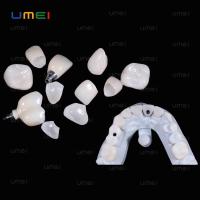 China Aesthetic Dental Veneers Instant Whitening Ultra Thin Hollywood White Veneers for sale