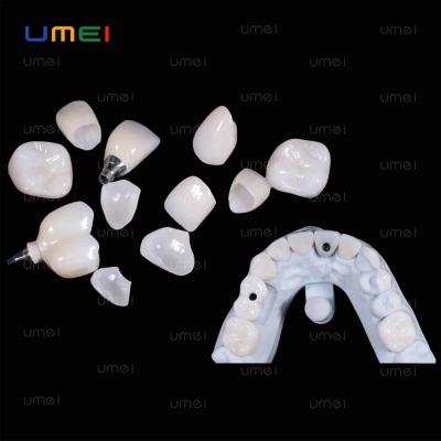China Aesthetic Dental Veneers Instant Whitening Ultra Thin Hollywood White Veneers for sale