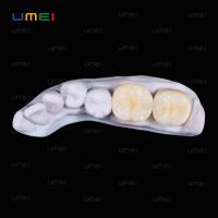 China All-Ceramic Dental Crowns-Bionic Aesthetic Restoration-Precision Fit Design-Biologically Safe and Friendl for sale