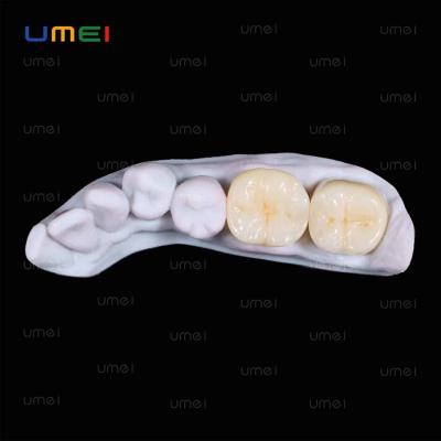 China All-Ceramic Dental Crowns-Bionic Aesthetic Restoration-Precision Fit Design-Biologically Safe and Friendl for sale