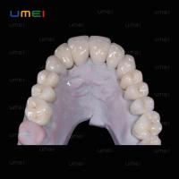 China Zirconia Crown-Superior Strength and Durability-Biological Safety-Precision Fit and Comfort for sale