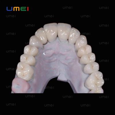 China Zirconia Crown-Superior Strength and Durability-Biological Safety-Precision Fit and Comfort for sale
