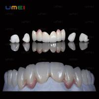 China Zirconia Fixed Partial Denture: A Dual Solution for Function and Aesthetics-Structural Design-Fabrication Precision for sale
