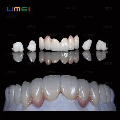 China Zirconia Fixed Partial Denture: A Dual Solution for Function and Aesthetics-Structural Design-Fabrication Precision for sale