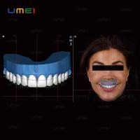 China High Hardness Zirconia DSD Digital Smile Design Minimally invasive for sale