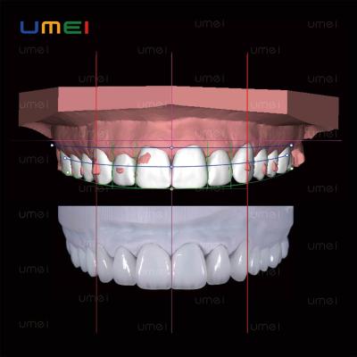 China Digital DSD-Guided Zirconia All-Ceramic Restoration: Precision Aesthetics and Functional Reconstruction-High Strength and Durability-Easy Maintenance for sale