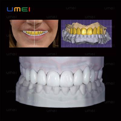 China Personalized Aesthetic Dental CAD Design , Custom DSD Digital Smile Design for sale