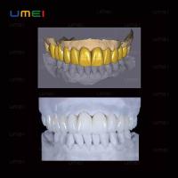 China Digital Dental Aesthetic Restoration Workflow-Precision Manufacturing-Aesthetic & Functional Balance for sale