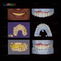 China Digital Implant & Aesthetic Restoration Workflow -Seamless Functional & Aesthetic Integration-Patient-Centric Workflow for sale