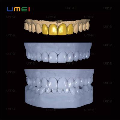China Digital Anterior Aesthetic Restoration Workflow-Precision Ceramic Fabrication-Aesthetic & Functional Harmony for sale