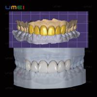 China Digital Anterior Aesthetic Restoration-Natural Aesthetic Harmony-Precision Fabrication for sale