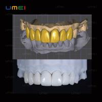 China Digital Anterior Aesthetic Restoration Workflow -Precision Fabrication-Natural Aesthetic Harmony for sale