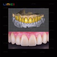 China Digital Anterior Aesthetic Restoration -Digital Diagnostic Wax-Up-Digital Diagnostic Wax-Up for sale