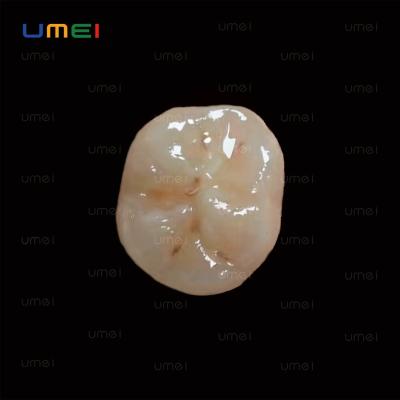 China Natural Aesthetic Dental Crown And Bridge High Transparency E.Max Crown for sale