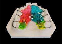 China Clinically Proven Dental Removable Appliance , Comfortable Fit Orthodontic Retainer for sale