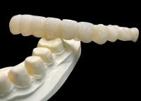 China Vita Classical Shade All Ceramic Crown Bridge Natural Looking For Dental Restoration for sale
