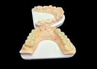 China Natural Aesthetics Translucent Ceramic Crowns for Dental Restoration with Easy Cleaning and Long-Lasting Results for sale