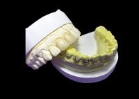 China Durable Wear Resistant Customized All Ceramic Crowns and Bridges for Perfect Fit and Long Lasting Performance for sale