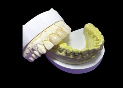 China Durable Wear Resistant Customized All Ceramic Crowns and Bridges for Perfect Fit and Long Lasting Performance for sale
