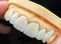 China High Strength Full Ceramic Crown Bridge with Exceptional Biocompatibility for Long-Lasting Durability for sale