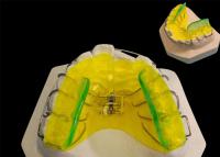 China Custom-Made Adjustable Orthodontic Appliances Clinically Proven for Teeth Alignment for sale