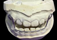 China Guide Arch Appliance Orthodontic Retainers Aligners With Good Retention Proven Convenience for sale