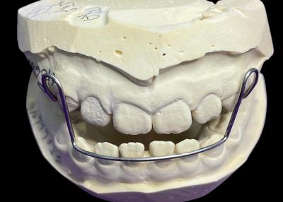 China Guide Arch Appliance Orthodontic Retainers Aligners With Good Retention Proven Convenience for sale