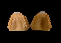 China Customized Aesthetic Zirconia Dental Crown Perfectly Fitted for Anterior and Posterior Teeth for sale