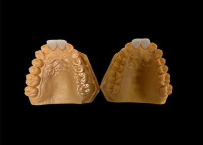 China Customized Aesthetic Zirconia Dental Crown Perfectly Fitted for Anterior and Posterior Teeth for sale
