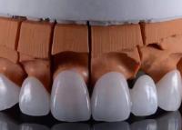 China FDA Approved Translucent Zirconia dental Crowns Precise Fit with Natural Aesthetic Appearance for sale