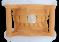 China Translucency Zirconia Dental Crown with Aesthetic Performance from China Dental Lab for sale