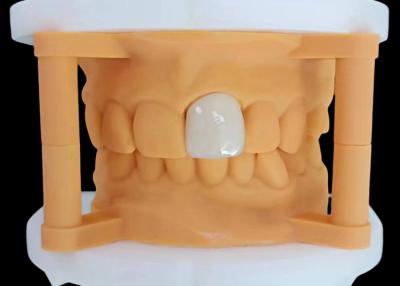 China Translucency Zirconia Dental Crown with Aesthetic Performance from China Dental Lab for sale