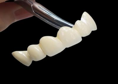 China Custom Translucent Zirconia Dental Crown With High Durability Stain Resistant from China dental lab for sale