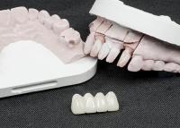 China Premium Zirconia Dental Crowns for Superior Strength and Natural Aesthetics for sale
