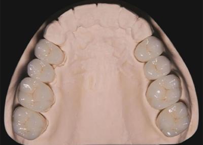 China Dental Restoration Teeth Zirconia dental Crowns crafted by china dental lab for sale