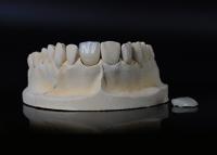 China Translucency Porcelain Emax Veneer for Excellent Fit / Natural Esthetics for sale