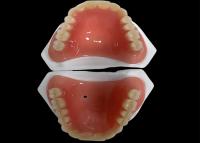 China Full Acrylic Dentures Lightweight Durable Affordable and Customizable Solution for Complete Tooth Replacement for sale