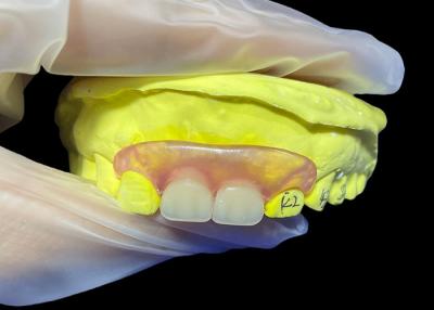 China Tailored Secure Fit invisible Flexible Parital Denture Replacement For Comfortable Chewing And Speaking for sale