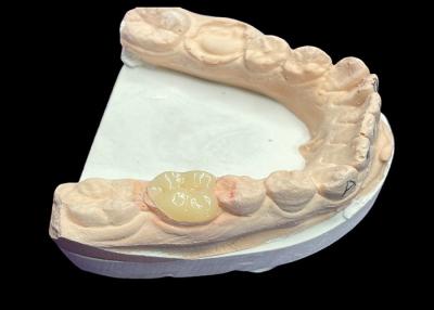 China Custom Smooth Dental Ceramic Inlay for Staining Resistant Seamless Tooth Repair and Natural Aesthetic for sale