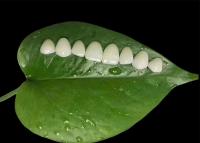 China Minimal Preparation Porcelain EMAX Veneer For Cosmetic Dental Treatment for sale